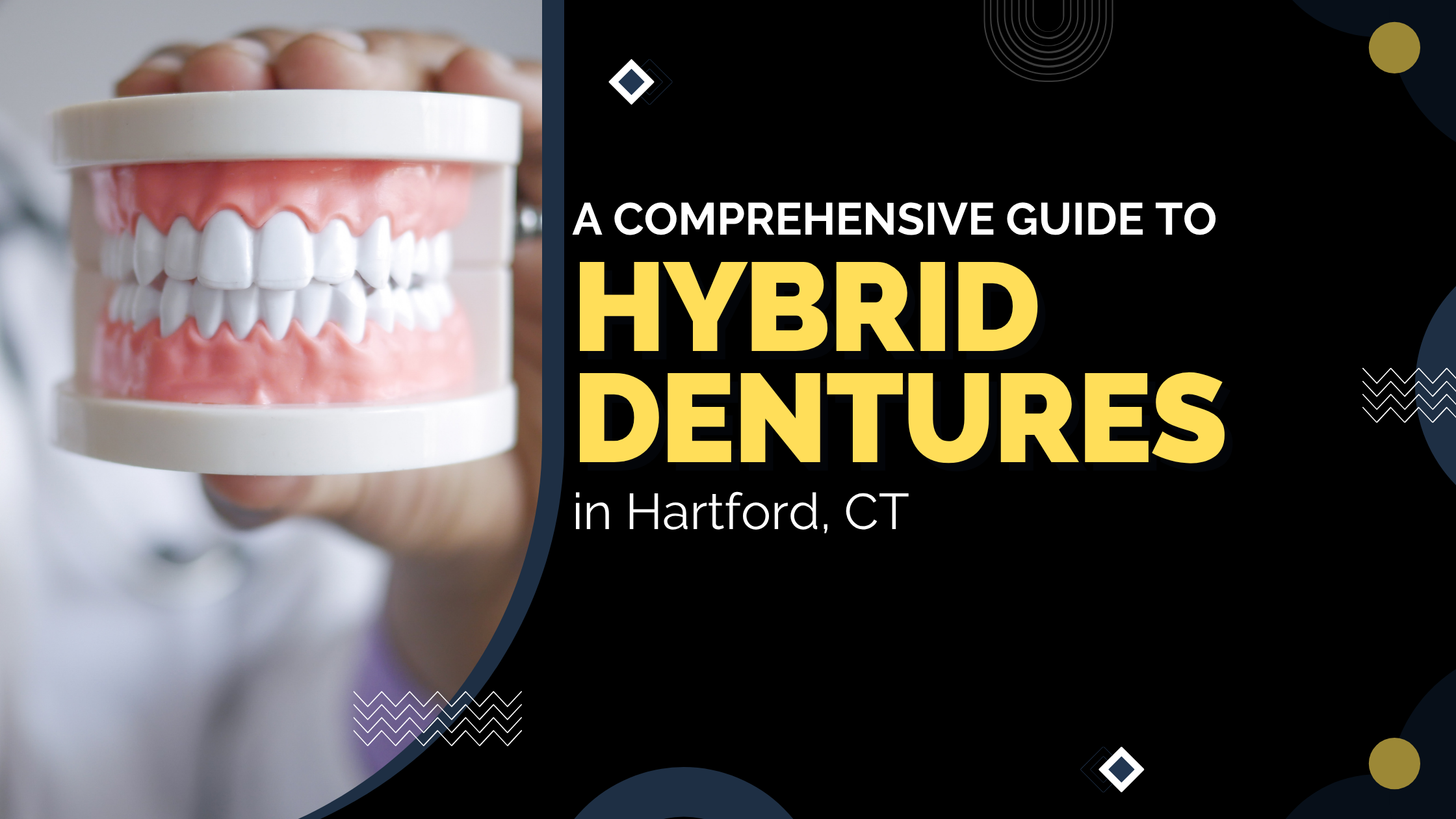 A Comprehensive Guide to Hybrid Dentures in Hartford, Connecticut ...